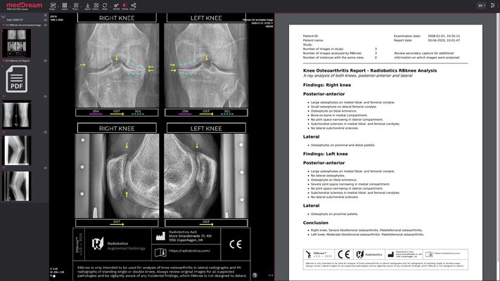 RBknee - Radiobotics