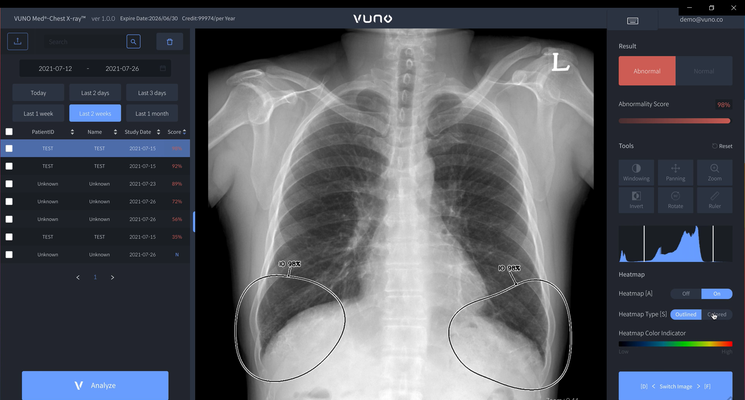 VUNO Med®-Chest X-ray™ - VUNO